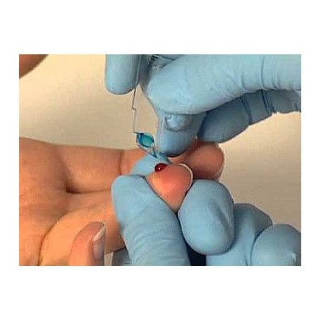 HemoCue WBC DIFF System | Medi-Shop.gr