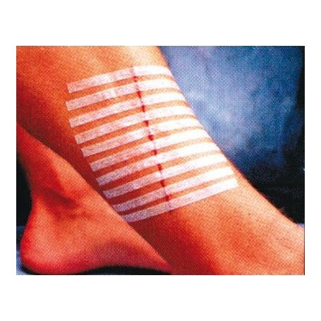Omnistrip wound closure strips | Medi-Shop.gr