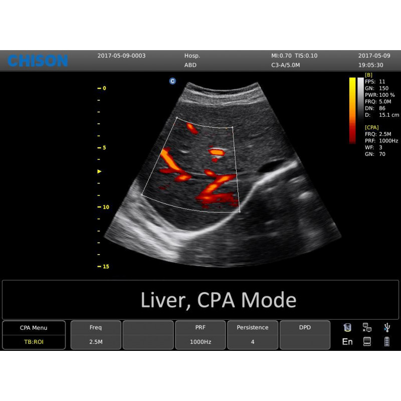 CHISON ECO6 color portable ultrasound with 1 transducer