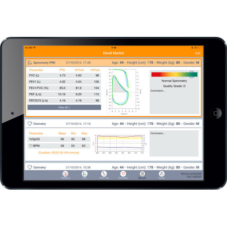 MIR Spirobank II Advanced spirometer | Medi-Shop.gr