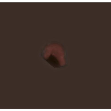 Πρόπλασμα χεριού ελέγχου αιμορραγίας 3B Scientific SKINlike dark skin ...